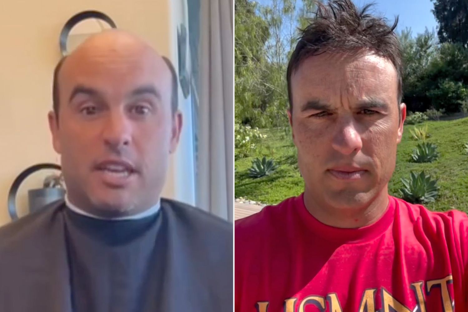 Former Soccer Star Landon Donovan Shows Before And After of Hair Piece ...