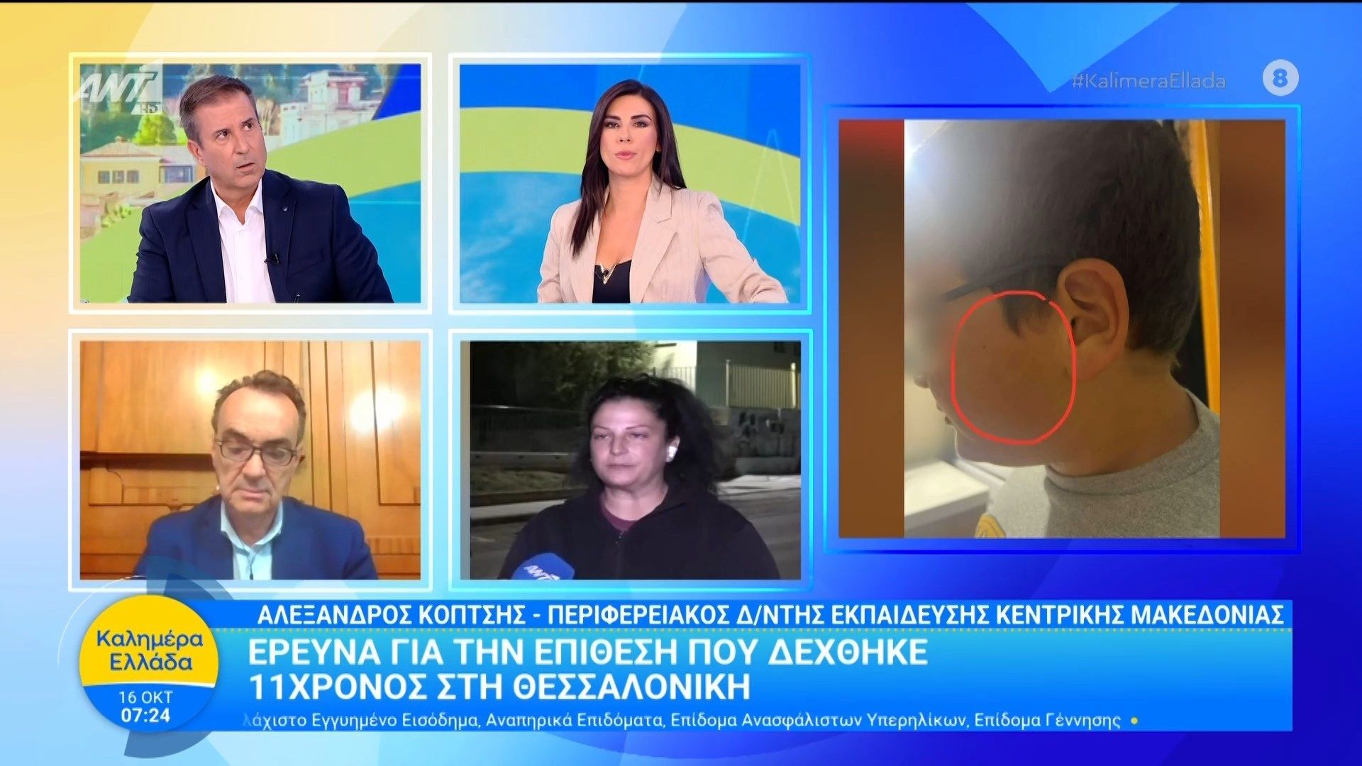 Θεσσαλονίκη: Έρευνα για την επίθεση που δέχθηκε 11χρονος – Καλημέρα ...