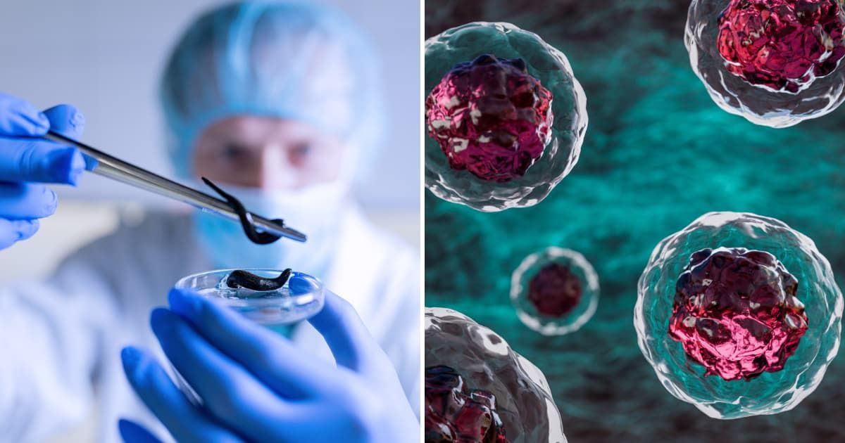 This Tiny Creature’s Incredible Ability Holds Clues About Growing Back ...