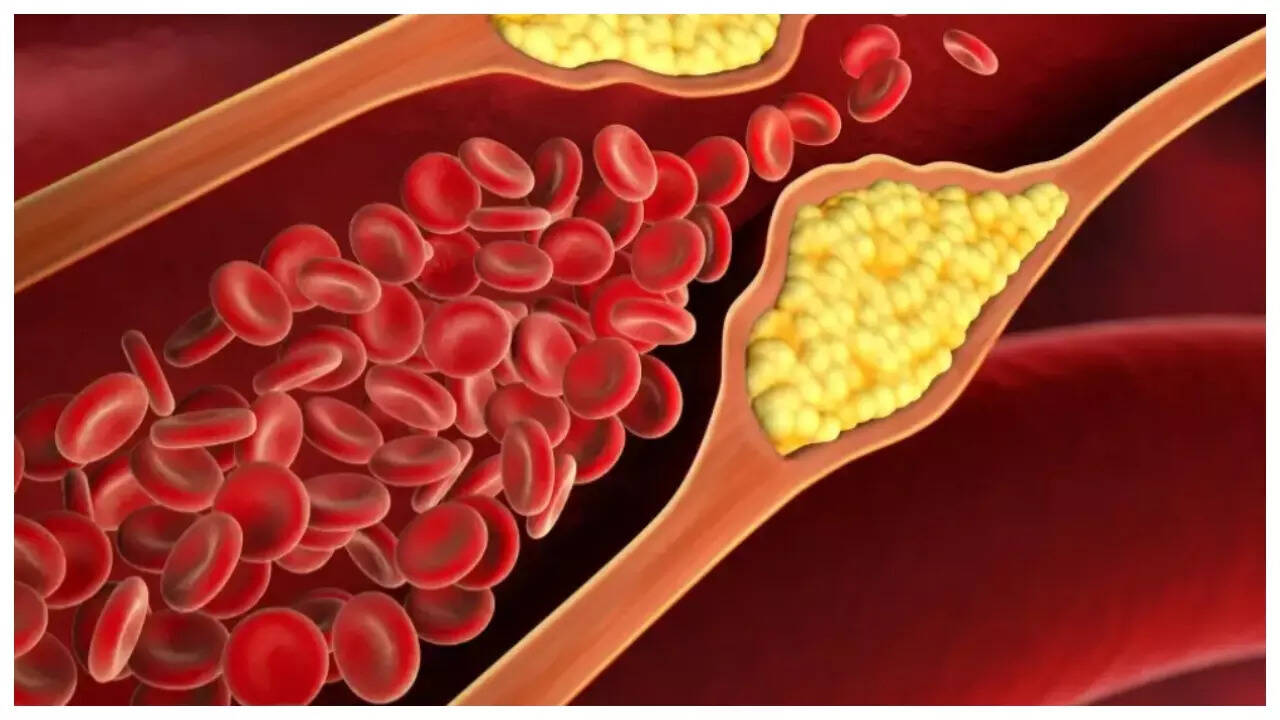 5 natural foods to help bring down cholesterol in 3 months