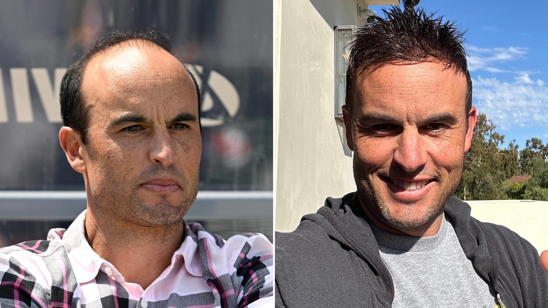 Soccer Star Landon Donovan Discusses ‘Insane' Reaction to His New Hairpiece