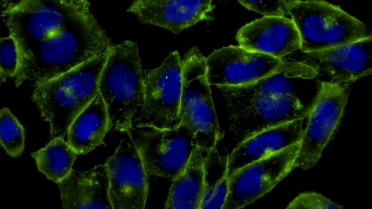 Science history: Scientists use 'click chemistry' to watch molecules in ...