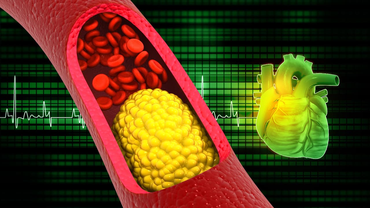 New Drug Cuts Bad Cholesterol by Nearly 60% in First-Year Trials