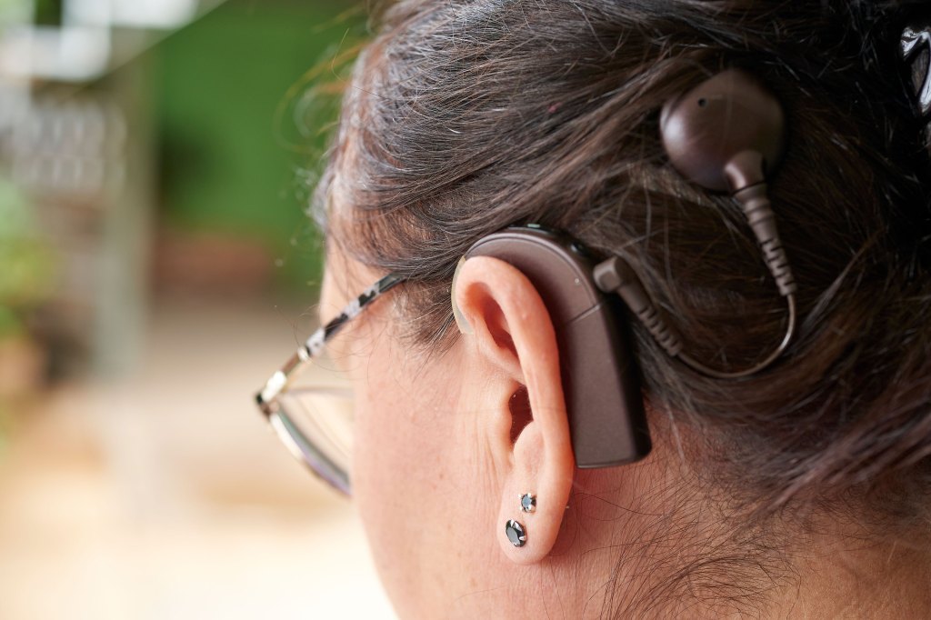 When a Hearing Aid Isn’t Enough