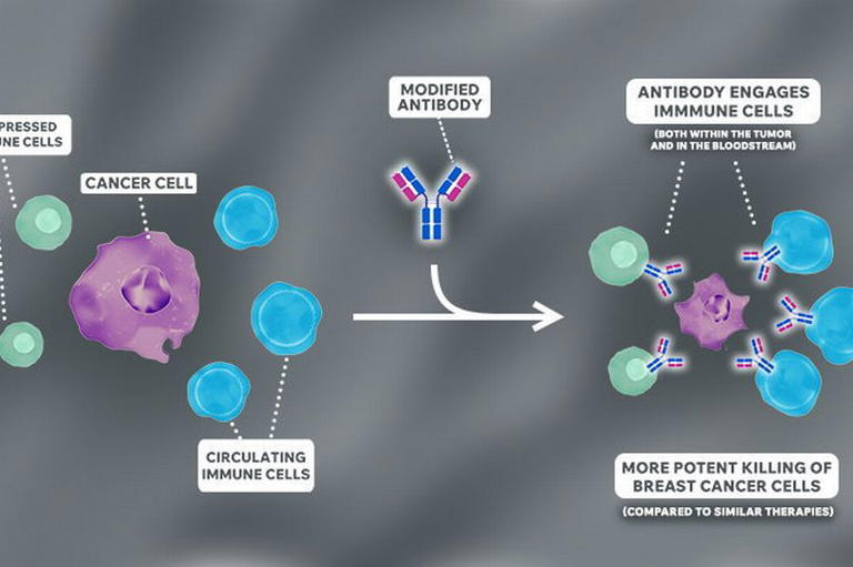 Hope for breast cancer patients thanks to new antibody treatment ...
