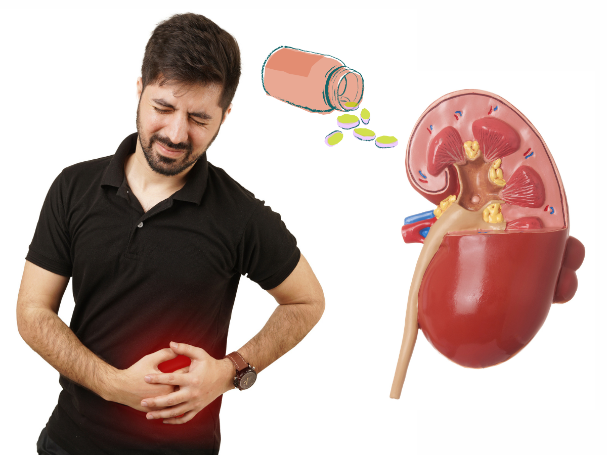 Kidney stones stopped before they start: Top expert reveals the key ...
