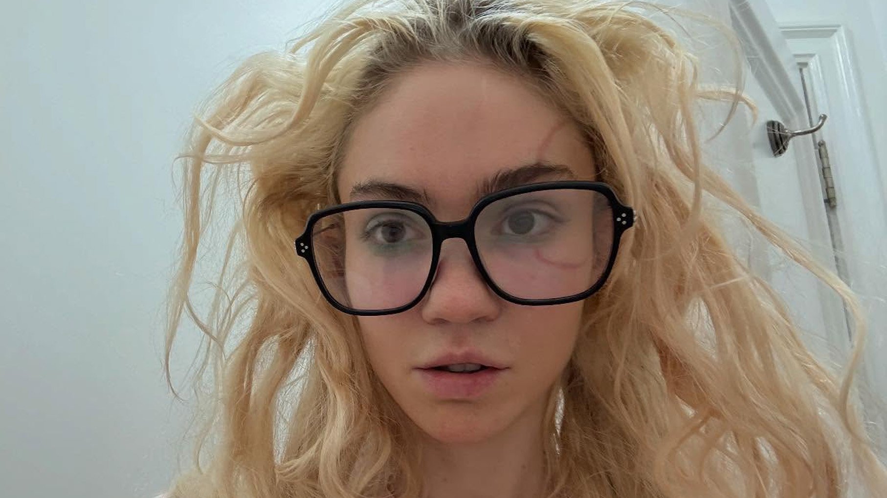 Grimes Shocks Fans with 'Ringworm' Face Tattoo