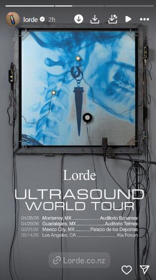 Lorde anuncia concierto en México 2026 con su gira “Ultrasound”: Fechas ...