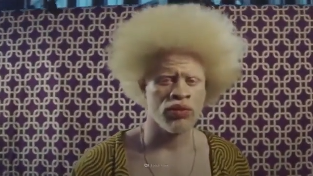 Qué tan vulnerable sería la humanidad si todos fuéramos albinos