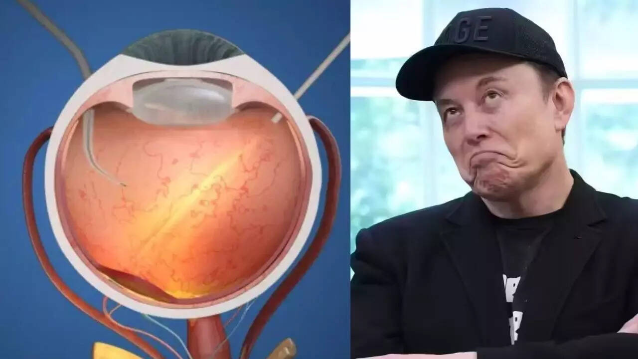 Elon Musk faces new rival as PRIMA retinal implant restores sight and ...