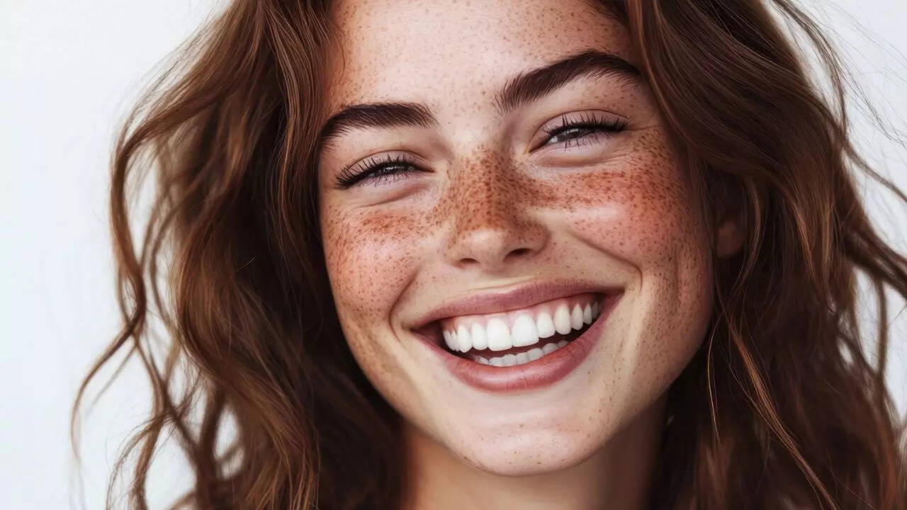 Understanding smile lines: Causes, treatments, and prevention strategies