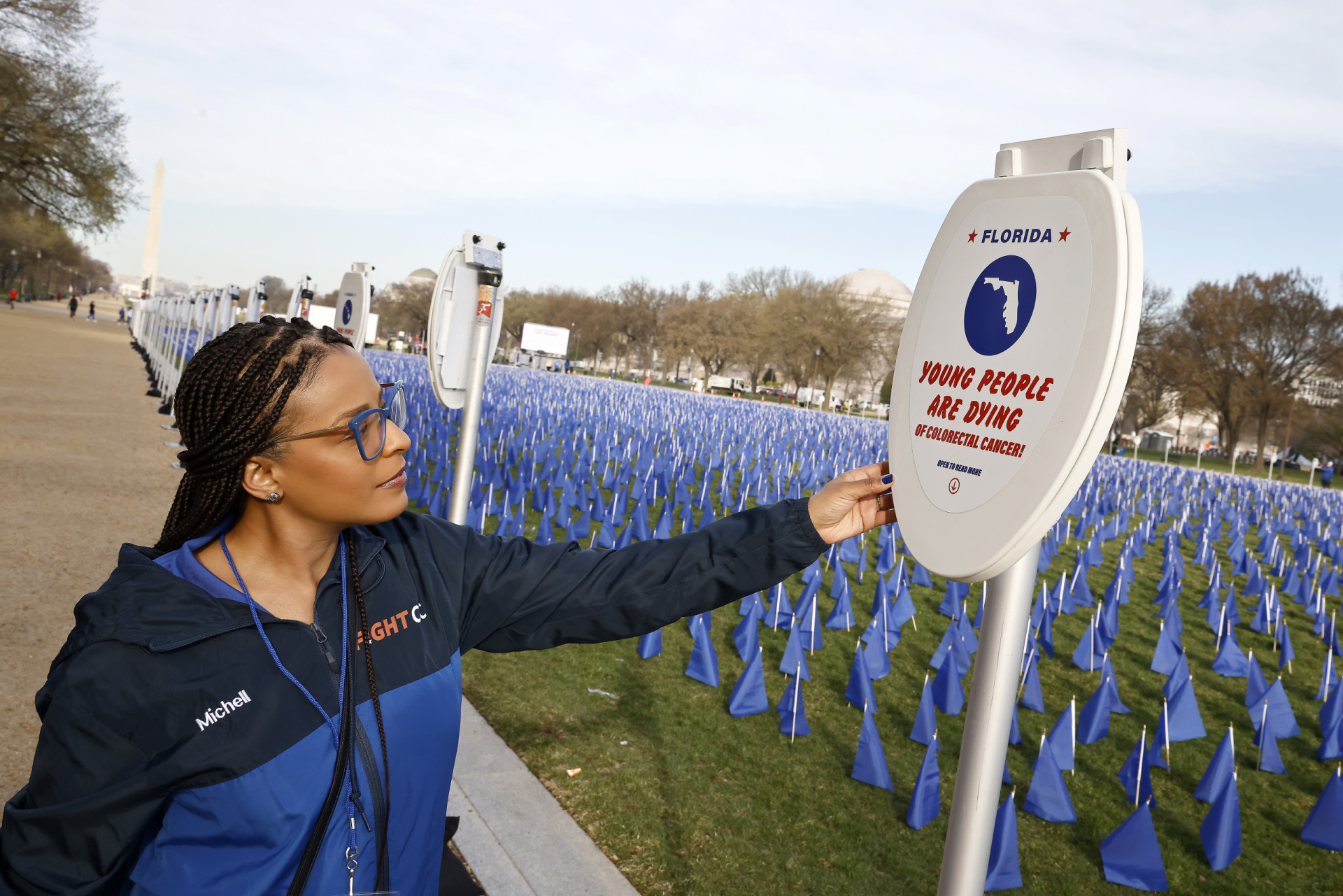 Colon cancer rising in young adults: warning signs