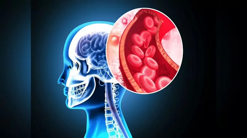 Health Tips - These seemingly normal symptoms could be the cause of a ...