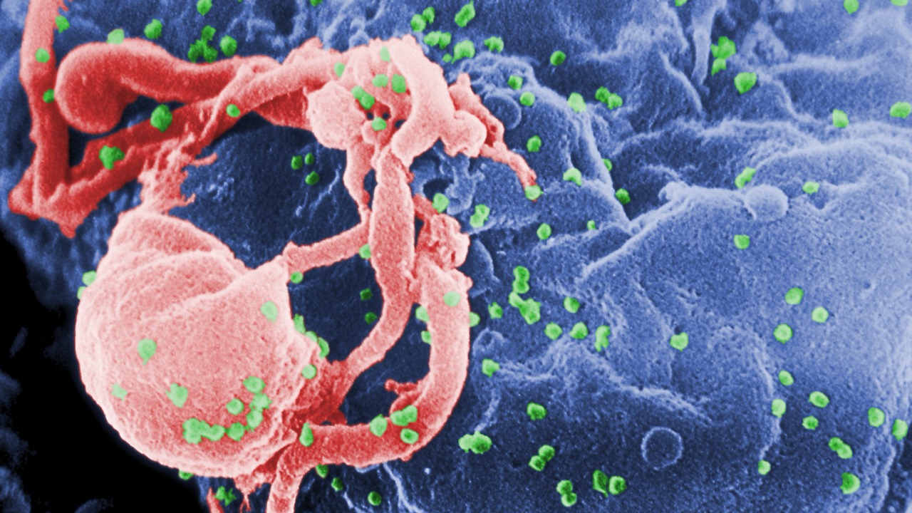 Researchers make major progress toward curing HIV