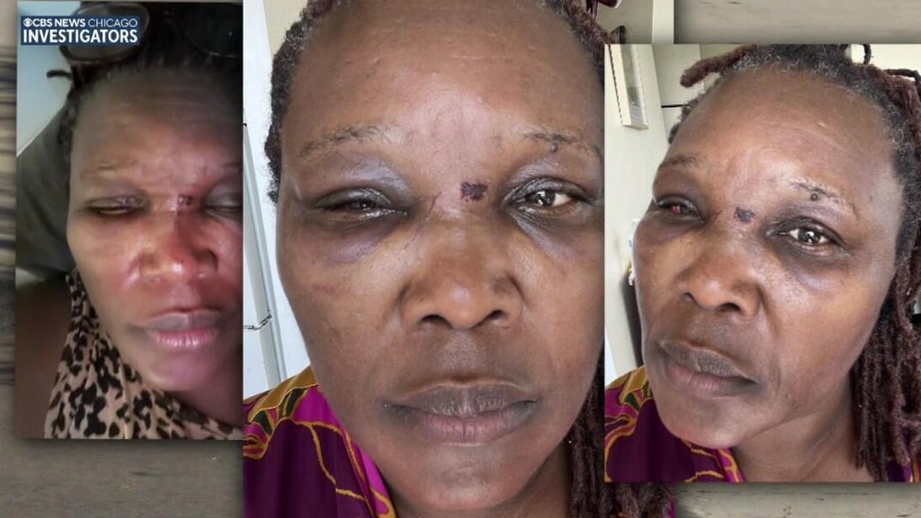 Woman punched in head in random attack in Chicago shares harrowing ...