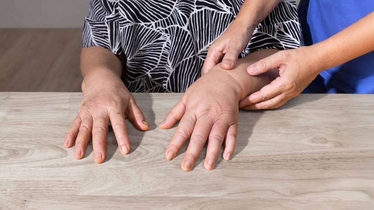 Hand, Foot And Mouth Disease Strikes U.S. Day-Cares: What Parents Must Know