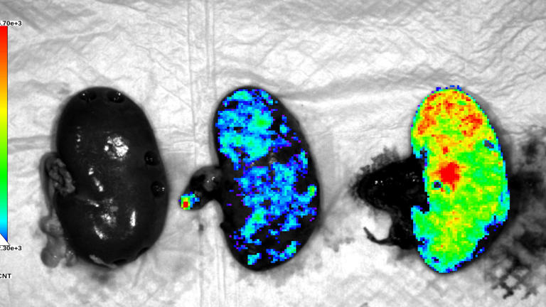 Pigs receive world’s first kidney transplants grown with human organoid ...