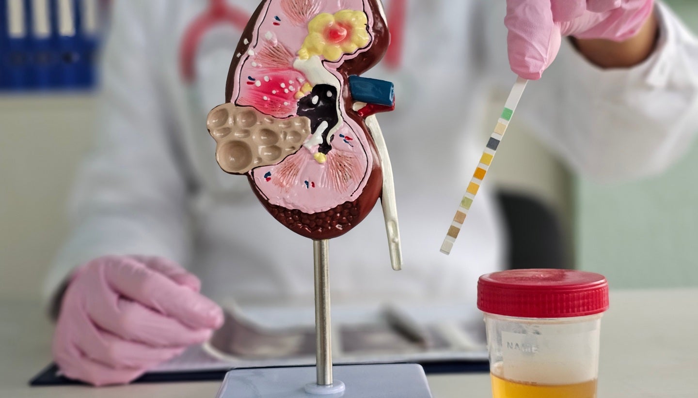 Helex secures $3.5m to advance kidney disease therapies