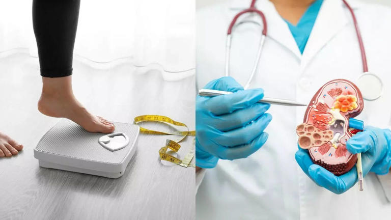 Can sudden weight gain or weight loss damage your kidneys? Know about ...