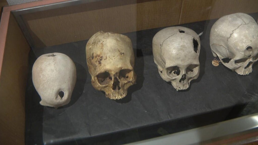 Chicago's Hidden Gems: International Museum of Surgical Science ...