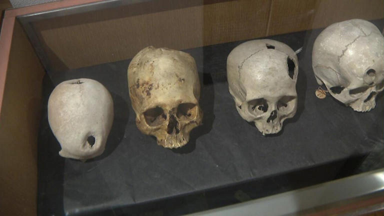 Chicago's Hidden Gems: International Museum of Surgical Science ...