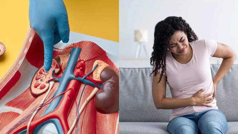 Kidney removal side effects: Understanding post-surgery pain, recovery ...