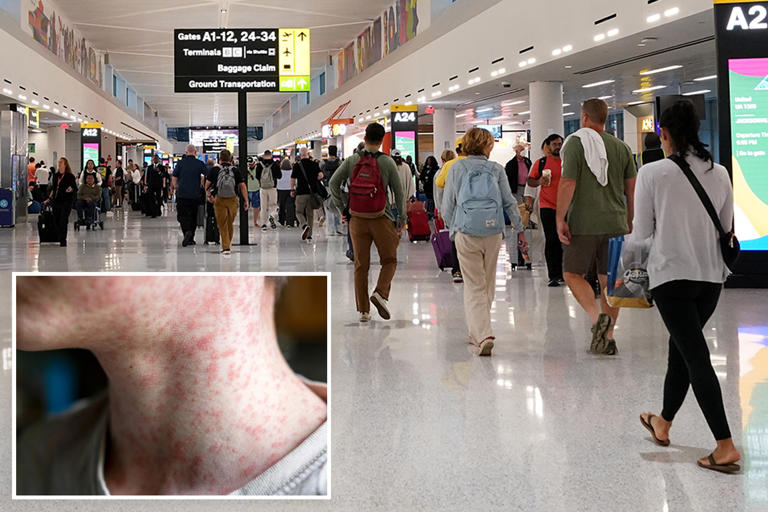 NJ issues health warning after passenger with measles travels through ...