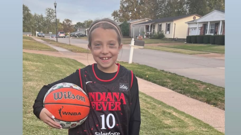 Lexie Hull Has Fitting 4-Word Response to Fever Fan Black Eye Halloween ...