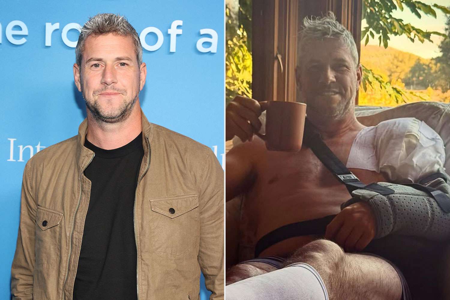 Ant Anstead Sustains Multiple Injuries, Including a 'Detached' Pectoral ...