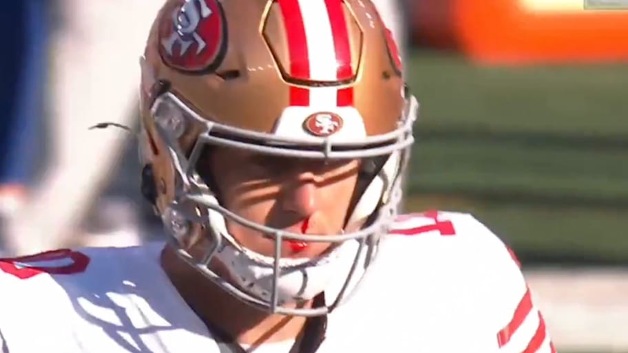 49ers’ Mac Jones Seen Bleeding Profusely After Taking Shot to Face From ...
