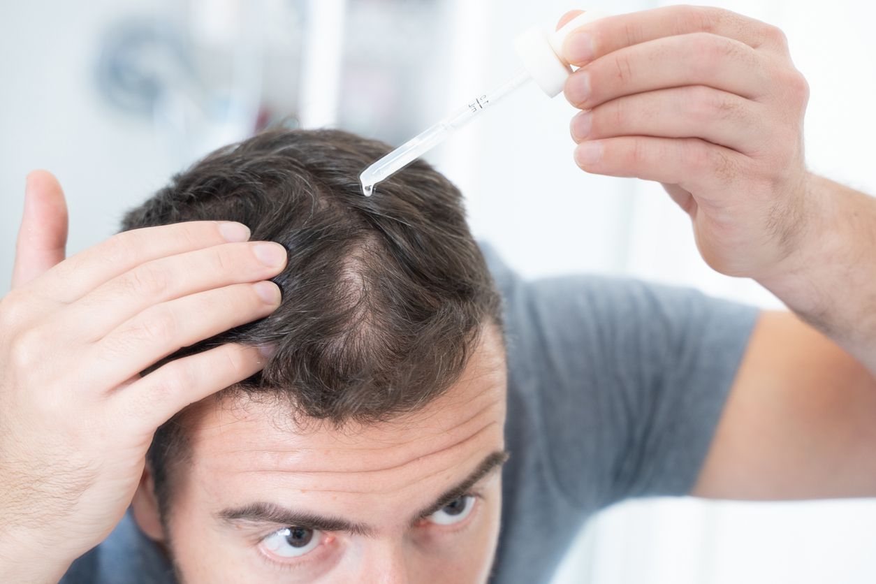 Nioxin vs. Rogaine: Which is better for my hair loss?