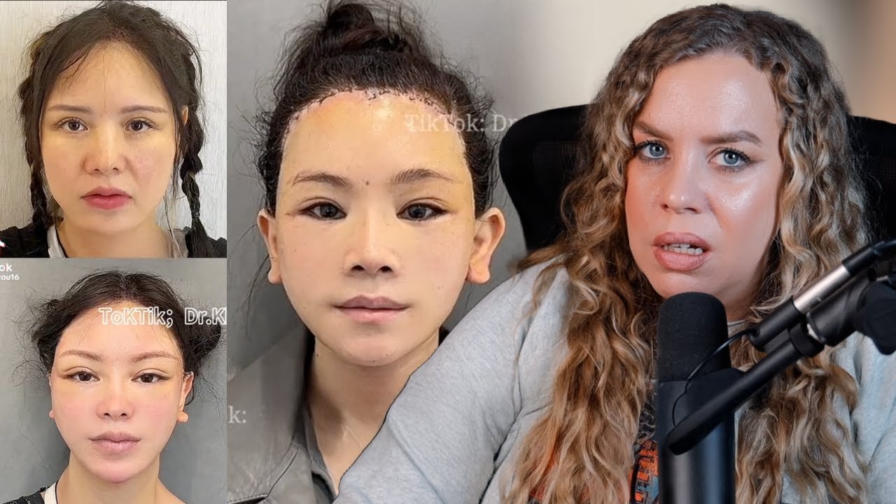 The Plastic Surgeon Turning Adults Into Scary Children