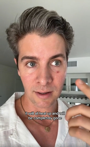 Krellner Face Laser Update: What Changed and What Didn’t
