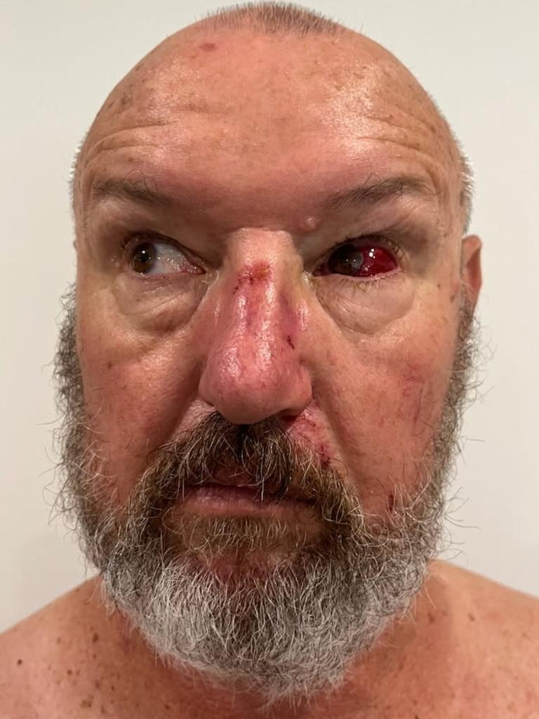 Twist after brutal prison officer assault