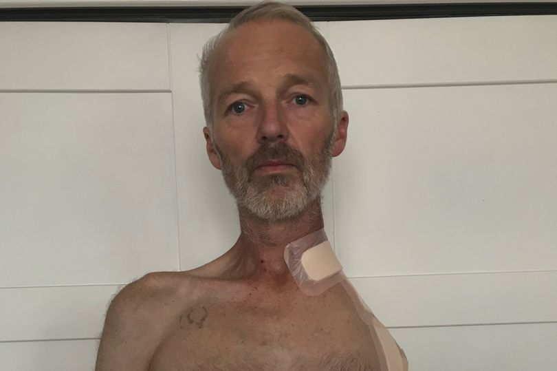 Cornwall amputee warns of 'devastating blow' facing rare cancer patients