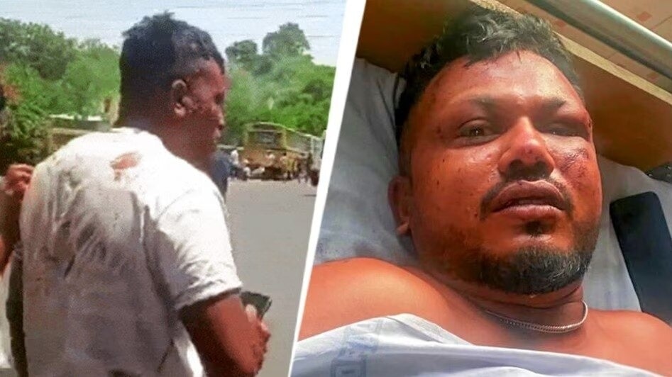 Lost and broken, not talking to family: Lone Air India crash survivor's ...