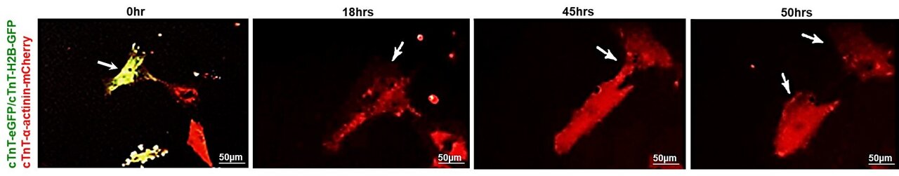 Specific human gene can help the heart repair itself from heart attack ...