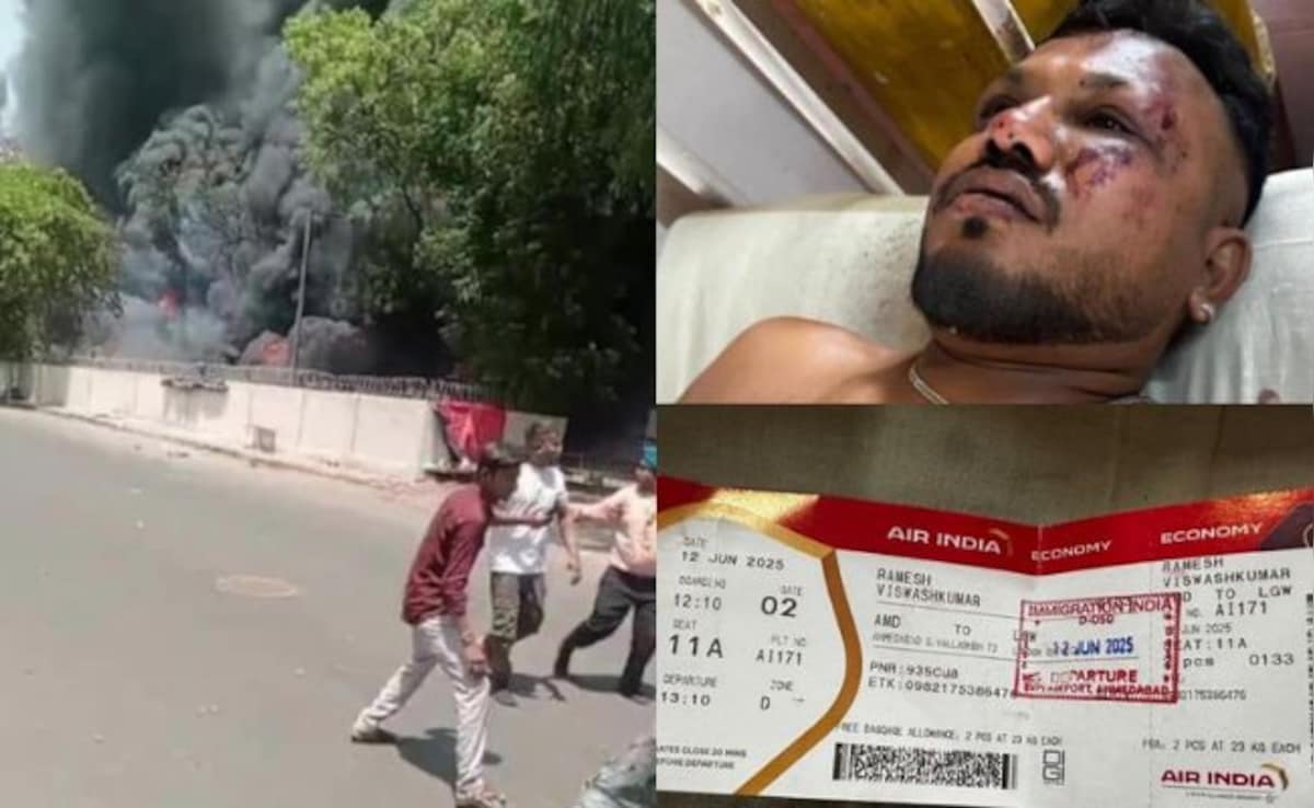 "Every Day Is Painful": Lone Air India Crash Survivor After Miracle Escape