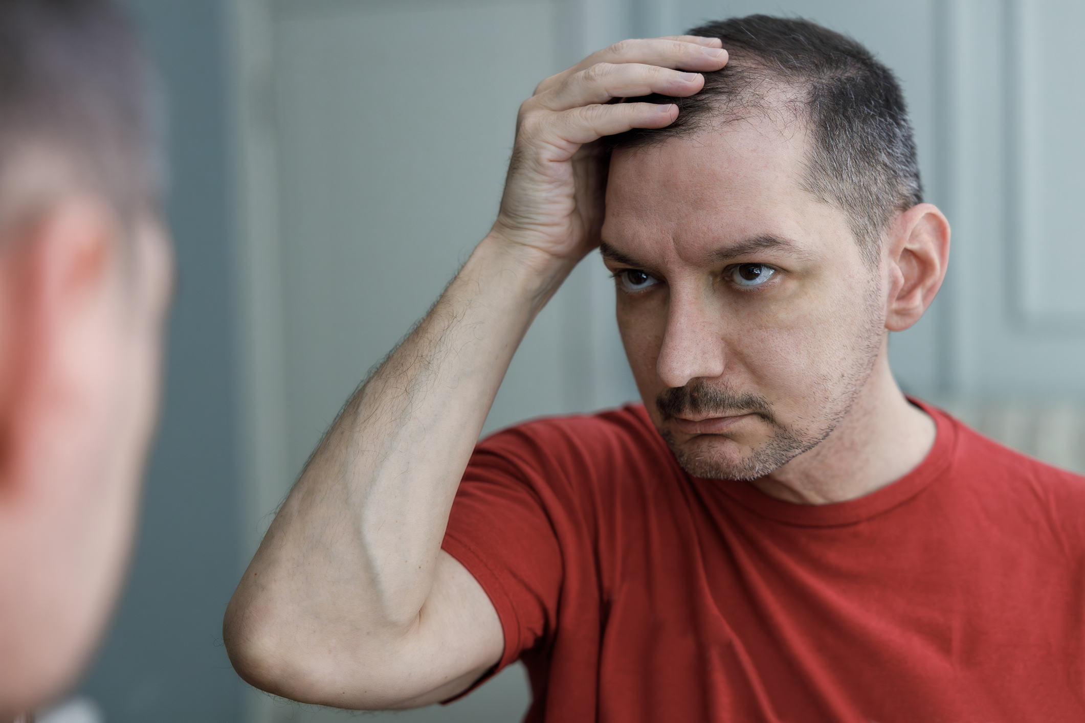 Guys: Here are 7 common reasons you might be going bald