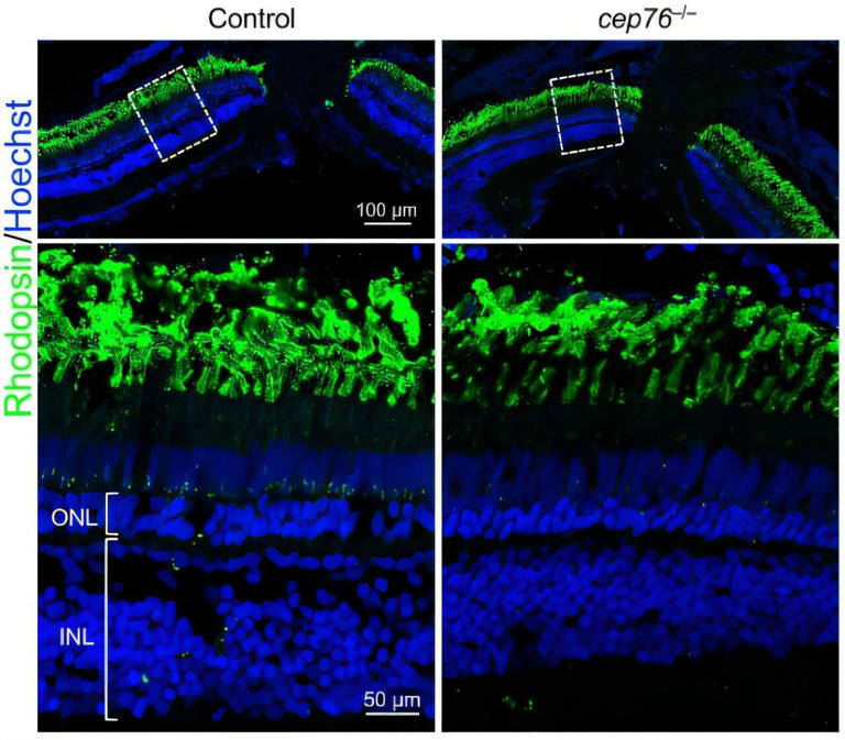 Gene CEP76 sheds light on cause of rare ciliopathy disorders