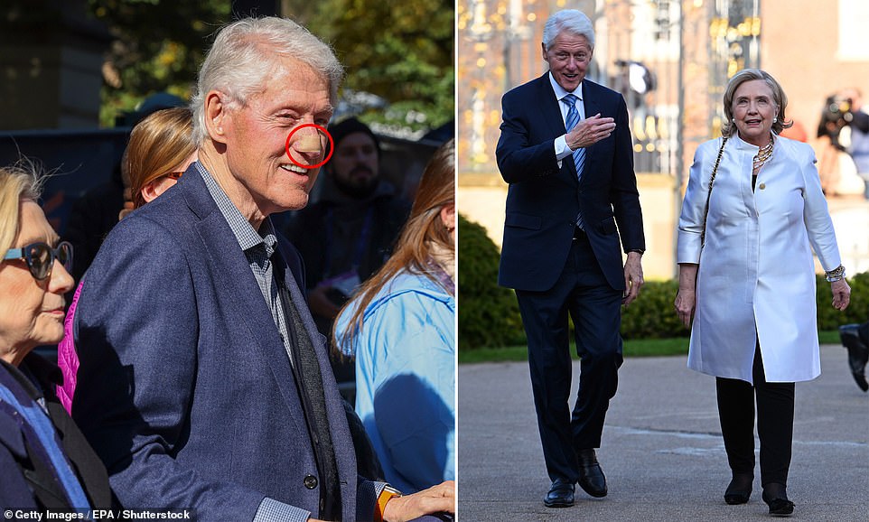 Fresh health fears for Bill Clinton as he shows up in NYC bandaged