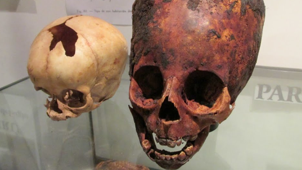 Unwrapping A 2000 Year Old Red Haired Elongated Baby Skull In Paracas Peru