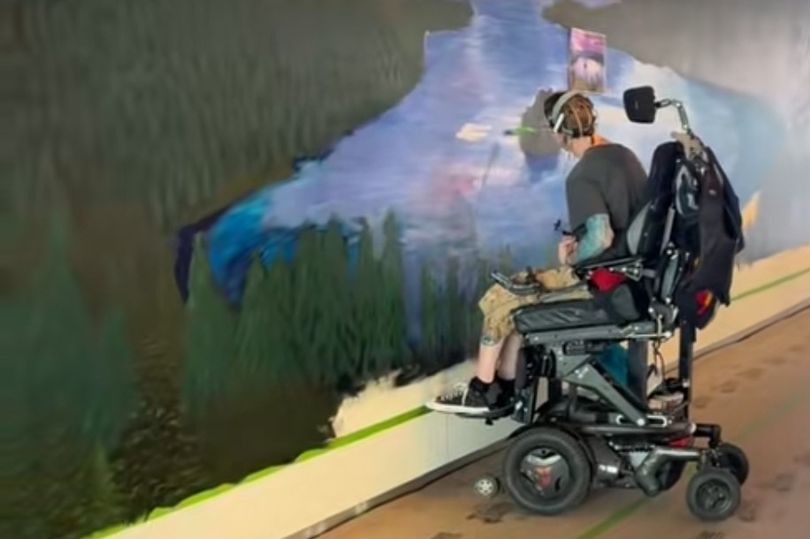 'I was born with major part of brain missing - but I skydive from my ...