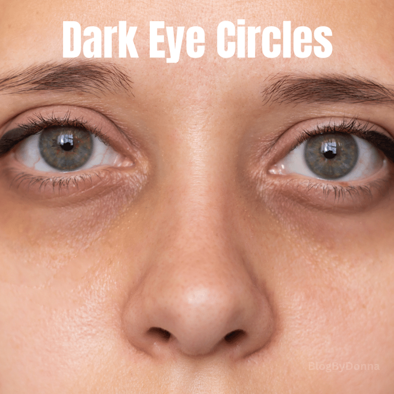 7 Skin Problems That No Skincare Can Fix