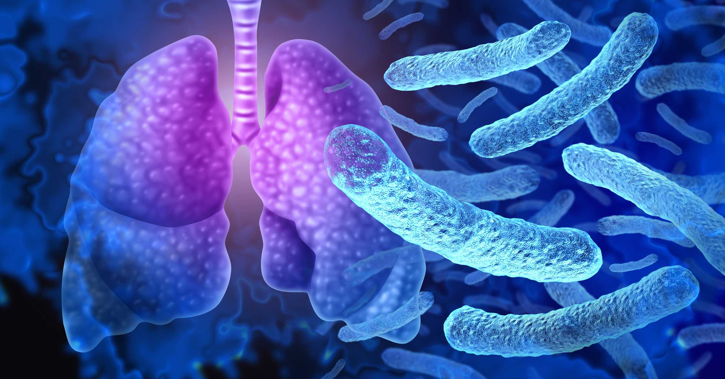 Christ Hospital identifies 2 cases of Legionnaires' disease, working to ...