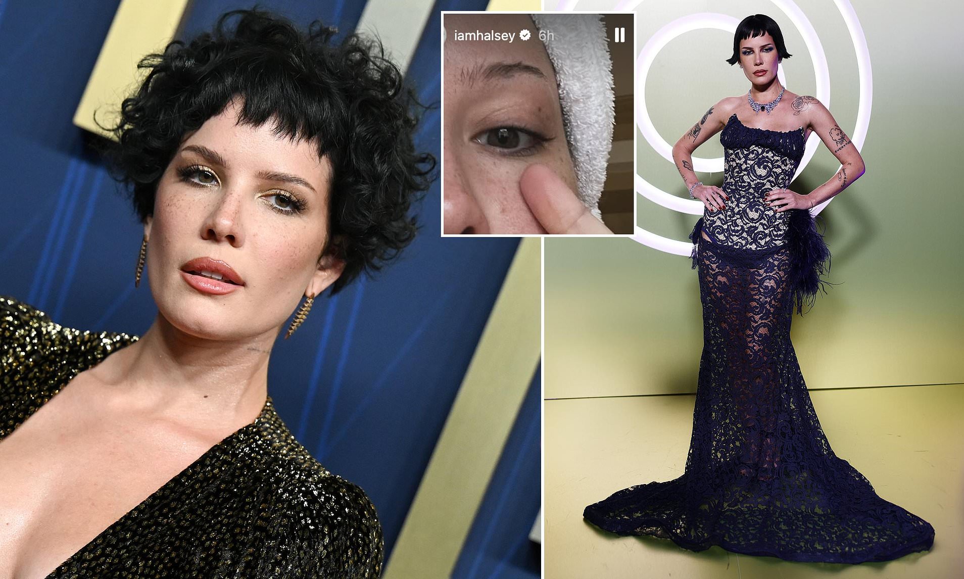 Halsey hospitalized after suffering 'medical emergency' following ...