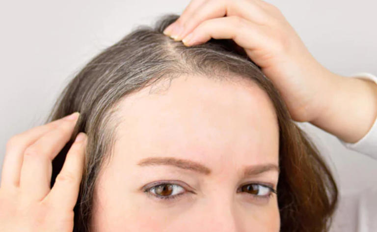 Premature Hair Greying: What's Triggering It And How To Reverse The Trend
