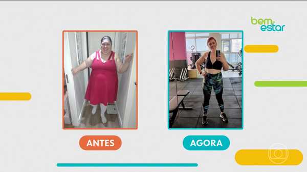 Sono e obesidade: mulher perde 100 quilos após bariátrica e mudança no ...