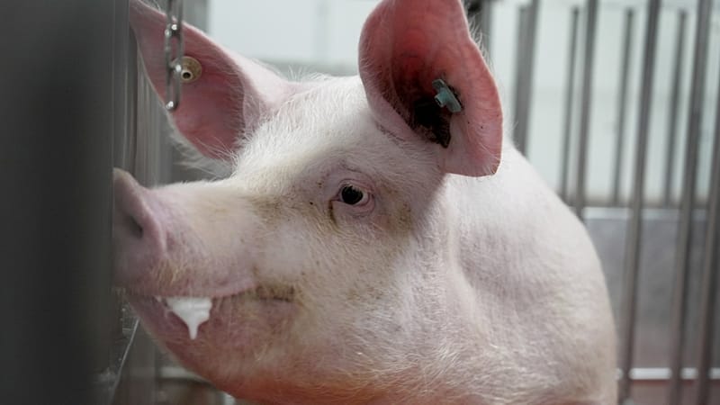First clinical trial testing pig kidney transplants in people launches ...