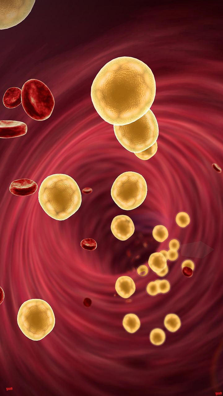 High Cholesterol Signs: कोलेस्टेरॉल वाढलंय हे शरीर आधीच सांगतं; फक्त ही ...